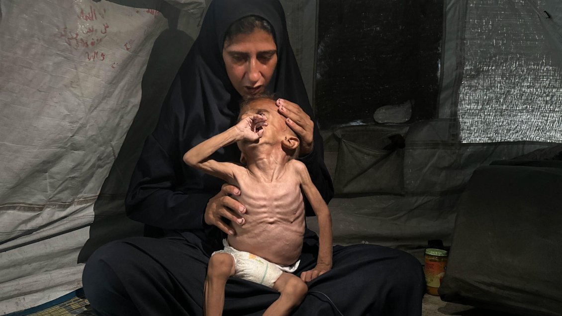 [Video] Enfermo y desnutrido: El niño de Gaza que según Israel es fake ...