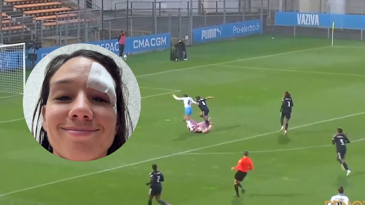 Christiane Endler recibió puntos de sutura en un ojo tras partido ante ...